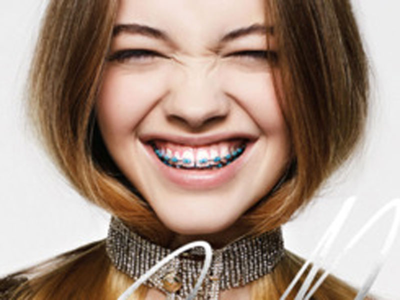 How to rock Braces your first day back